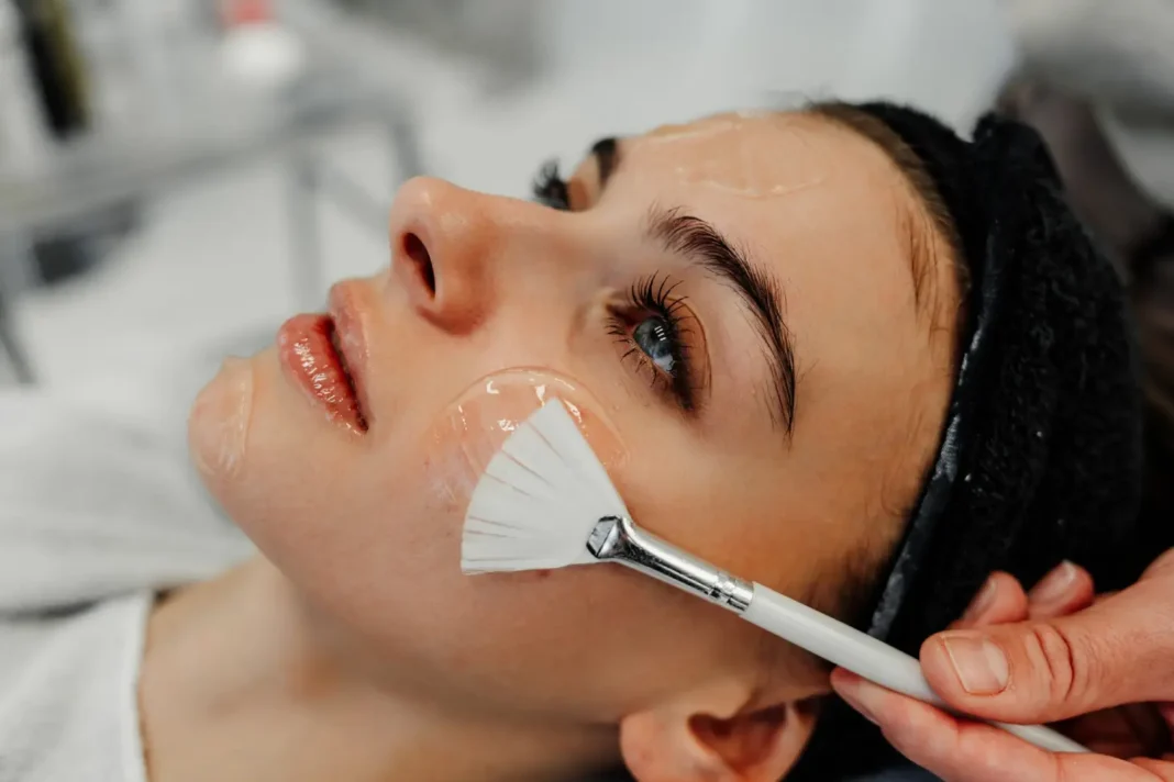 Struggling With Dull Skin? Why Chemical Peels Remain a Popular Option ...